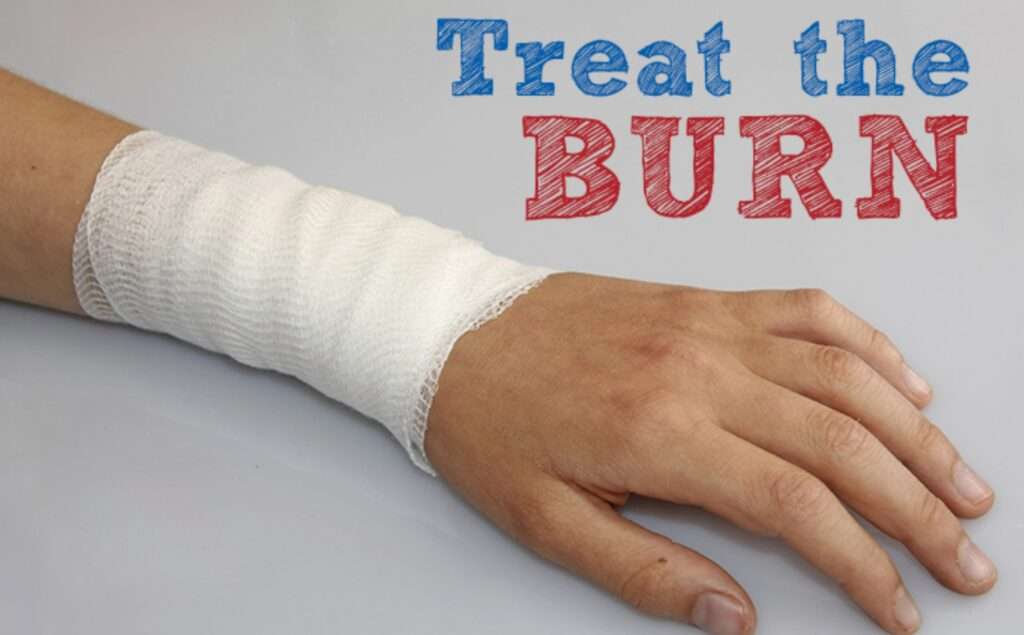 ANECDOTAL FIRST AID IN BURNS - Dr. Ashish Gupta